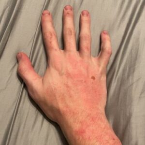 Best Laundry Detergents for Sensitive Skin - Prevent Rashes